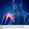 회전근개염 원인 증상 어깨에 극심한 통증이 발생하고 있다면 네이버 블로그